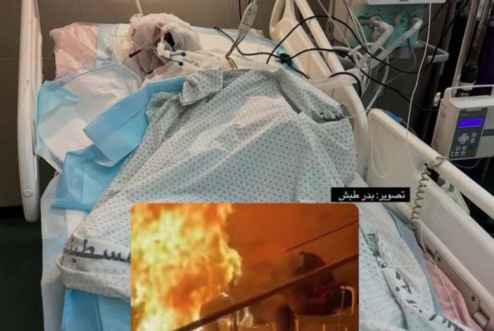 Burned alive: Gaza journalist in critical condition after Israeli ...