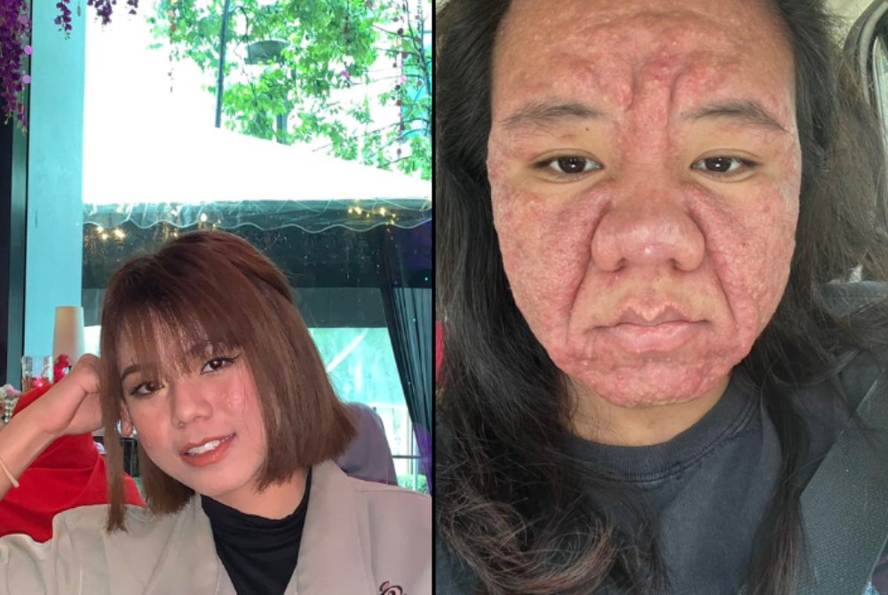 The skin I didn’t expect: The extreme facial changes this mum faced ...