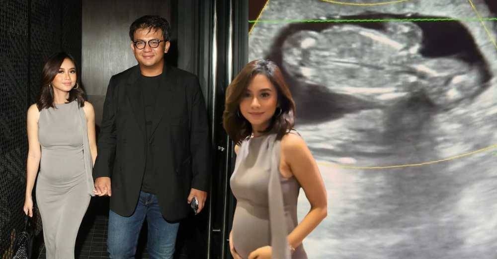 Tahniah! Intan Najuwa hamil anak sulung. 'Kami bakal bertiga' - SinarPlus