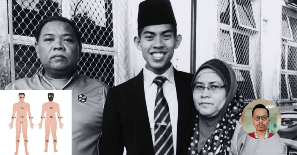 Allahyarham Zulfarhan alami 80 peratus kelecuran, doktor ini kongsi ...