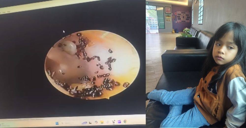 'Kaki mencengkam, kulit akan terkoyak sikit...' Anak mengadu sakit ...