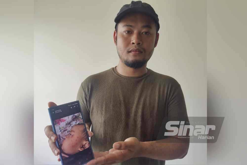 Semut charlie 'serang' Pangsapuri Melodi Perdana - Sinar Harian