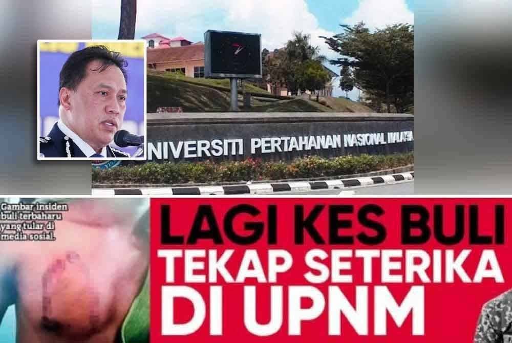 Kes buli pegawai kadet UPNM: Seterika dipercayai digunakan ketika ...